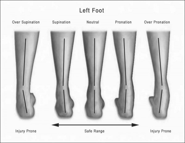 Shin Splints: How Smart Coaches Avoid Them - Freelap USA