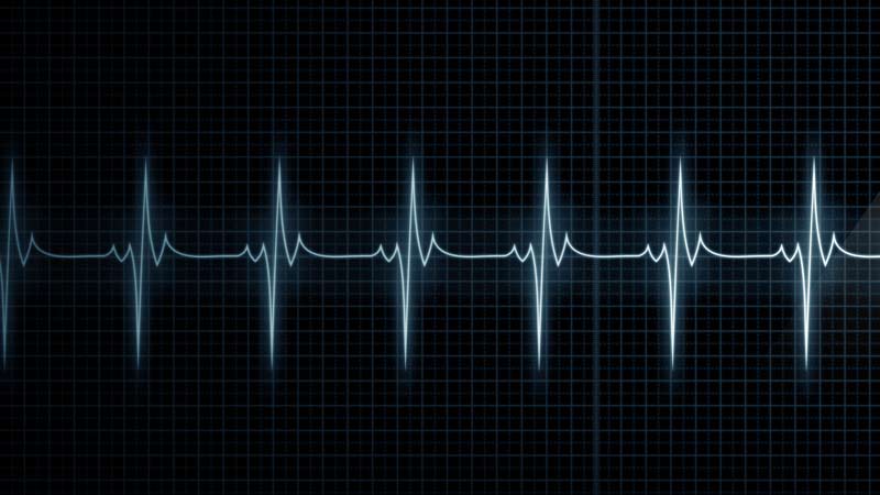 Interpreting HRV Trends in Athletes: High Isn’t Always Good and Low Isn ...